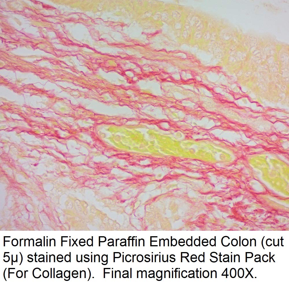 Picrosirius Red Stain Pack (for Collagen), 500ml