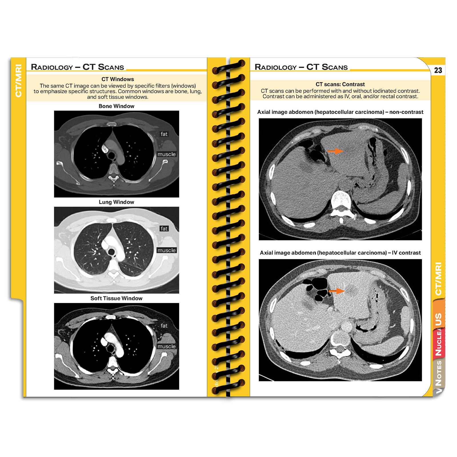 MDpocket Radiology & Imaging