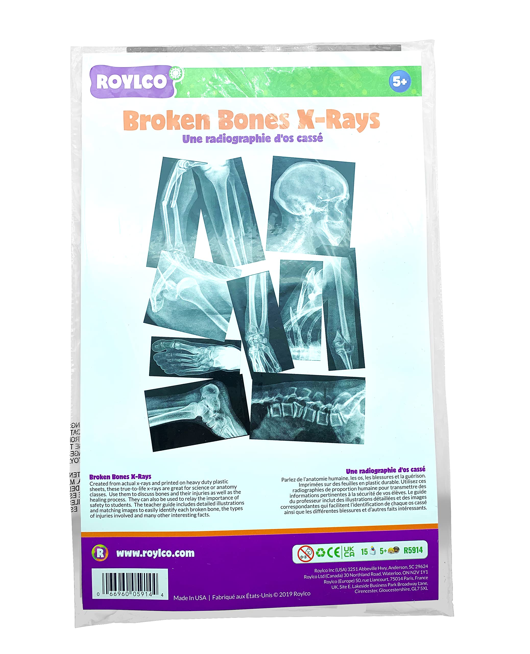 Roylco Broken Bones X-Rays – 15 Realistic Fracture Images for STEM/STEAM Learning, Classroom Anatomy, Health Education, and Labs – Perfect for Teachers, Parents, and Medical Training