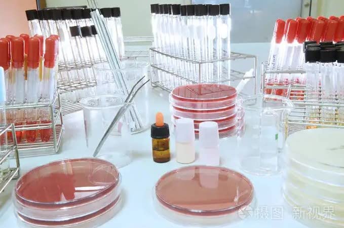 Othmro 20ml 100pcs Plastic Lab Centrifuge Tubes, 21 * 109mm Vial Test Tube Sample Storage Container Liquid Centrifuge Tube Round Bottom with Plug-in Cap for Beads Yeast Specimen Sample Laboratory