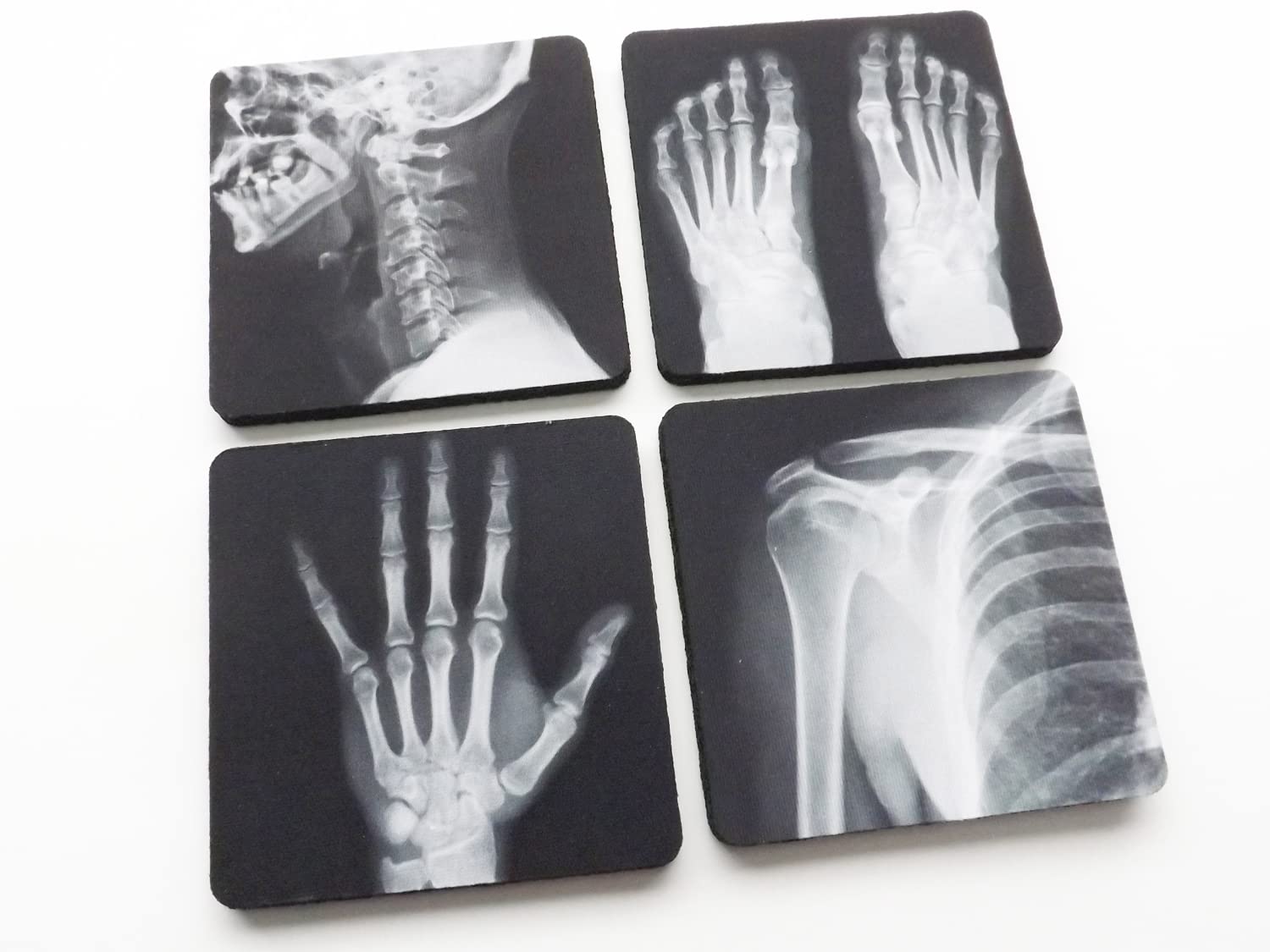 Radiology Drink Coasters Set of 4 or 6 Neoprene or Hardboard Xray Tech Imaging Radiologist Graduation Gift Doctor Nurse