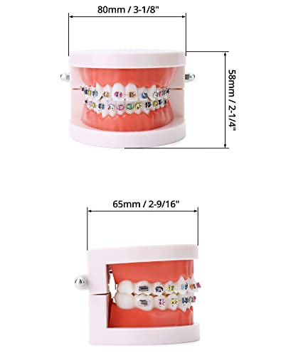 QWORK Typodonts Orthodontics Demonstration Model, Dental Tooth Research Model with Metal Wires and Ceramic Brackets, Teaching Teach Explanation Model for Adults