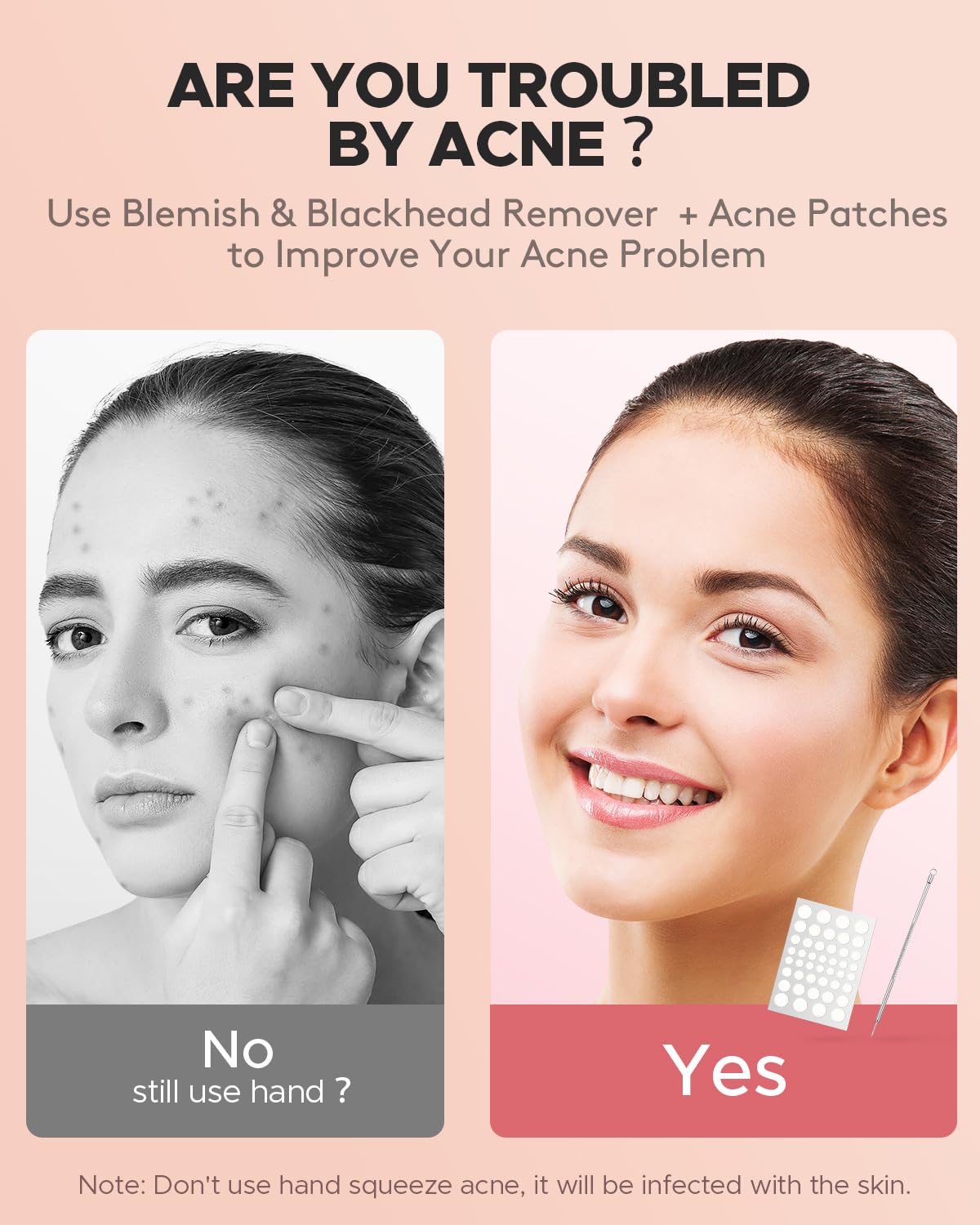 Pimple Patches with Extractor, Hydrocolloid Acne Patches for Face 4 Sizes 176 Count for Zit Breakouts, 2-in-1 Blackhead Remover & Pimple Popper Tool with Tea Tree & Calendula Oil