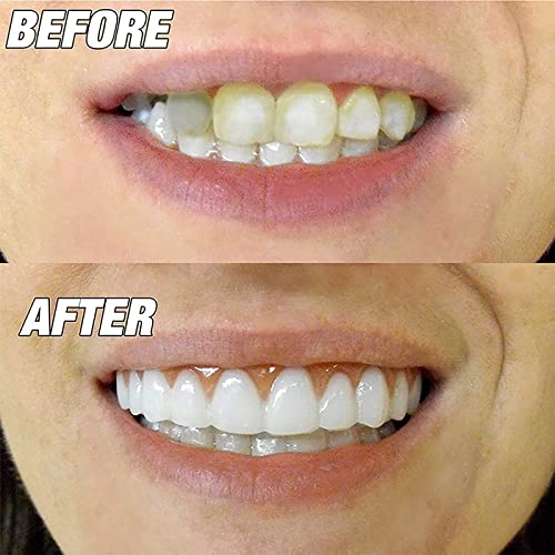 Snap on Teeth You Can Eat with - Adjustable Snap-On Dentures, Cover The Imperfect Teeth, Denture Teeth Temporary Fake Teeth for Snap on Instant & Confidence Smile (Top, Female)