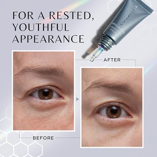 COSMEDIX Under Eye Serum for Dark Circles & Puffiness, Opti Crystal - Lifting & Firming Liquid Serum for Fine Lines & Wrinkles - Brightening, Moisturizing, & Hydrating Anti Aging Eye Puffy Bags Serum
