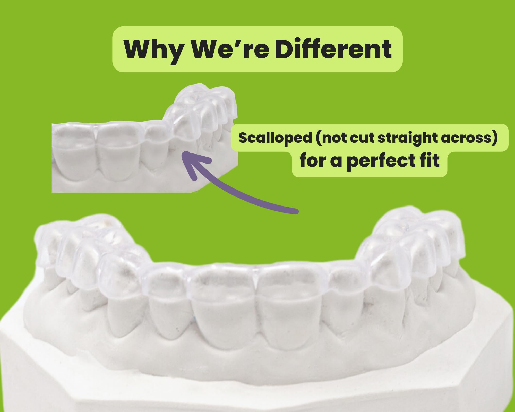 SENTINEL MOUTHGUARDS Durability Mouth Guard for Heavy Teeth Grinding and Jaw Clenching | Comfortable and Custom Fit | Dentist-Grade Material | Long-Lasting Protection | BPA-Free