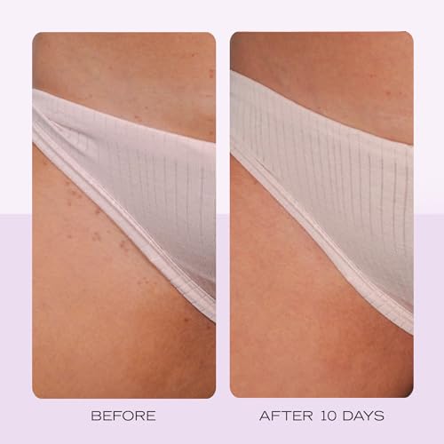 First Aid Beauty Ingrown Hair Pads with BHA + AHA – Ingrown Treatment Pads Exfoliate to Help Prevent Razor Bumps – For Underarm + Bikini Area – Compostable for Daily Use – 60 pads