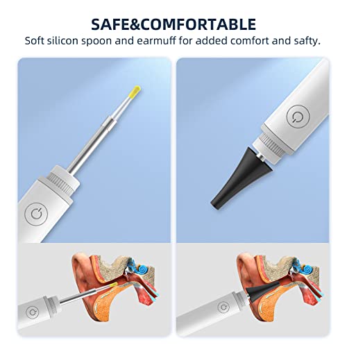 Ear Scope, Ear Wax Removal Tool Camera Wireless Otoscope 1080P Ear Cleaner Camera, Otoscope with Light Ear Wax Remover, Ear Endoscope Compatible with iPhone iPad Android