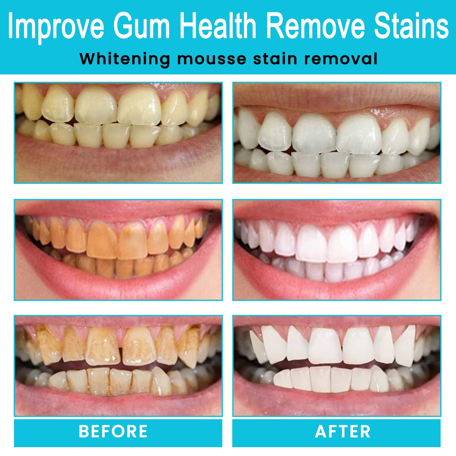 Foam Toothpaste,Whitening Toothpaste,Ultra-fine Mousse Foam Deeply Cleaning Gums,for Deep Cleaning of Gums, Stain Removal & Fresh Breath - Travel Friendly(2 x 50ml)