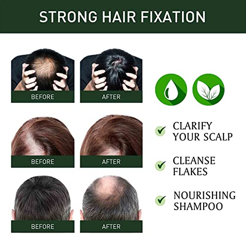 LANEMAY Ginger Essence Hair Growth Spray, Pure Ginger Prevent Hair loss Hair Growth Spray - 30ml