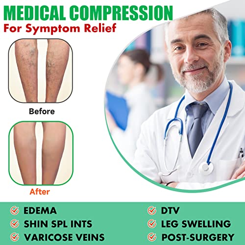 MGANG Compression Socks, 15-20 mmHg Graduated Knee High Compression Stockings for Unisex, Class I, Open Toe, Opaque, Support Hose for DVT, Pregnancy, Varicose Veins, Relief Shin Splints, Beige L