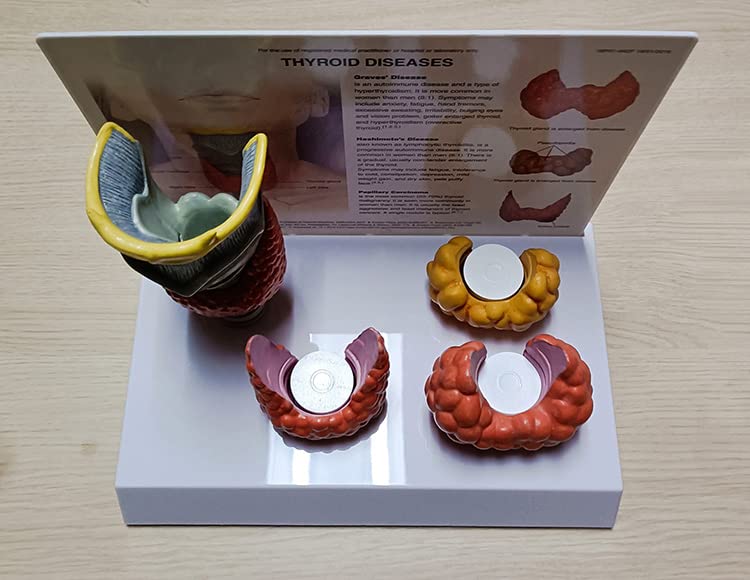 KH66ZKY Thyroid Anatomy Model - Thyroid Nodule Model - for Science Classroom Study Display Thyroiditis Mastoid Cancer Teaching Medical Model