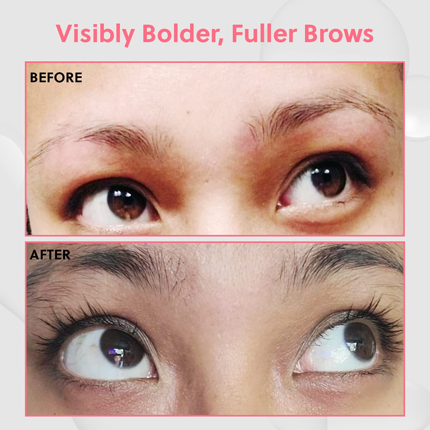ForChics ForBrow Eyebrow Growth Serum For Thicker Brows - Natural & Organic Conditioner For Fuller and Thick Eyebrows | Vegan & Cruelty-Free Formula | New Innovative Peptides - [0.10 fl. oz/ 3ml]