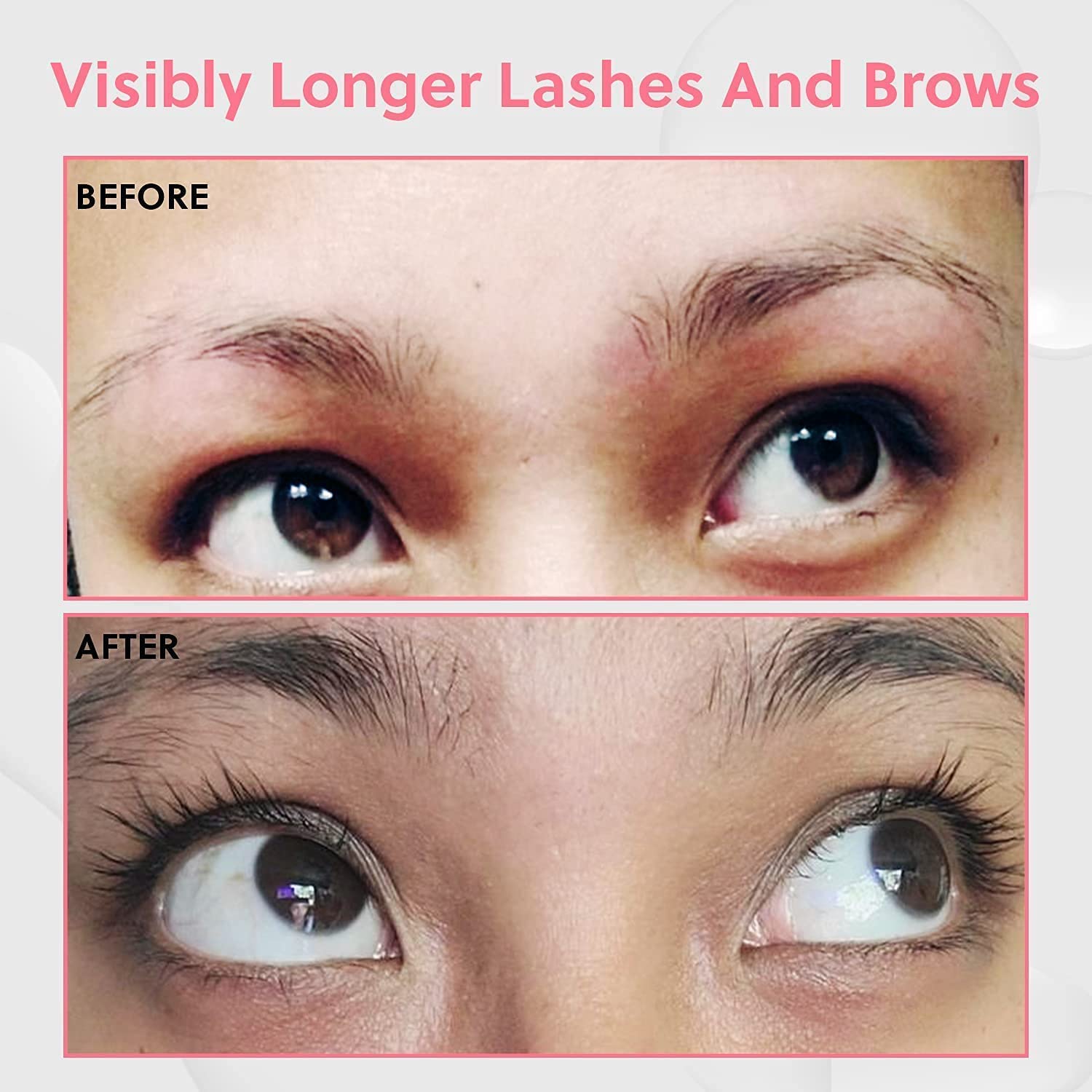 ForChics ForLash Eyelash Growth Serum Bundle with ForBrow Eyebrow Growth Serum - Fuller, Thicker, and Longer Eyelashes & Eyebrows | Organic & Natural | Vegan & Cruelty-Free Formula - [0.10 fl. oz/3ml]