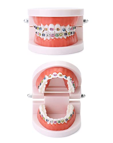 QWORK Typodonts Orthodontics Demonstration Model, Dental Tooth Research Model with Metal Wires and Ceramic Brackets, Teaching Teach Explanation Model for Adults