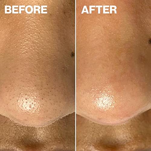 DERMAFLASH LUXE Anti-Aging Sonic Dermaplaning Exfoliation Tool for Women, White