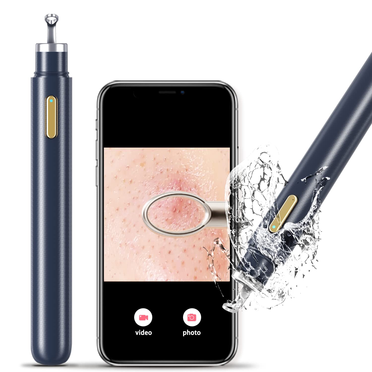 Men’s Visible Blackhead Extractor[2022 New], Advanced Pimple Popper with 20X Camera Acne Comedone Whitehead Zit Remover Tool, womfenn Facial Pore Extraction Tools Kit