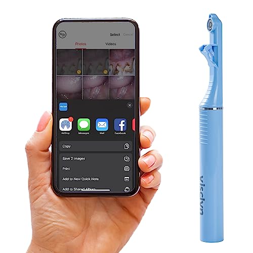 visclyn Smart Dental Floss| Viewable Oral Check and Teeth Floss for Baby and Family | Screenshot and Video Record for Sharing via App - Blue