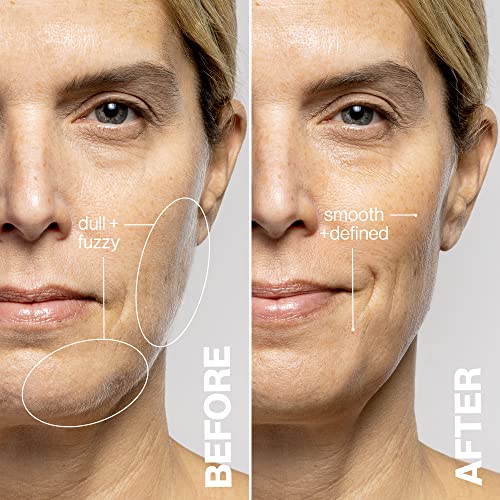 DERMAFLASH LUXE Anti-Aging Sonic Dermaplaning Exfoliation Tool for Women, White