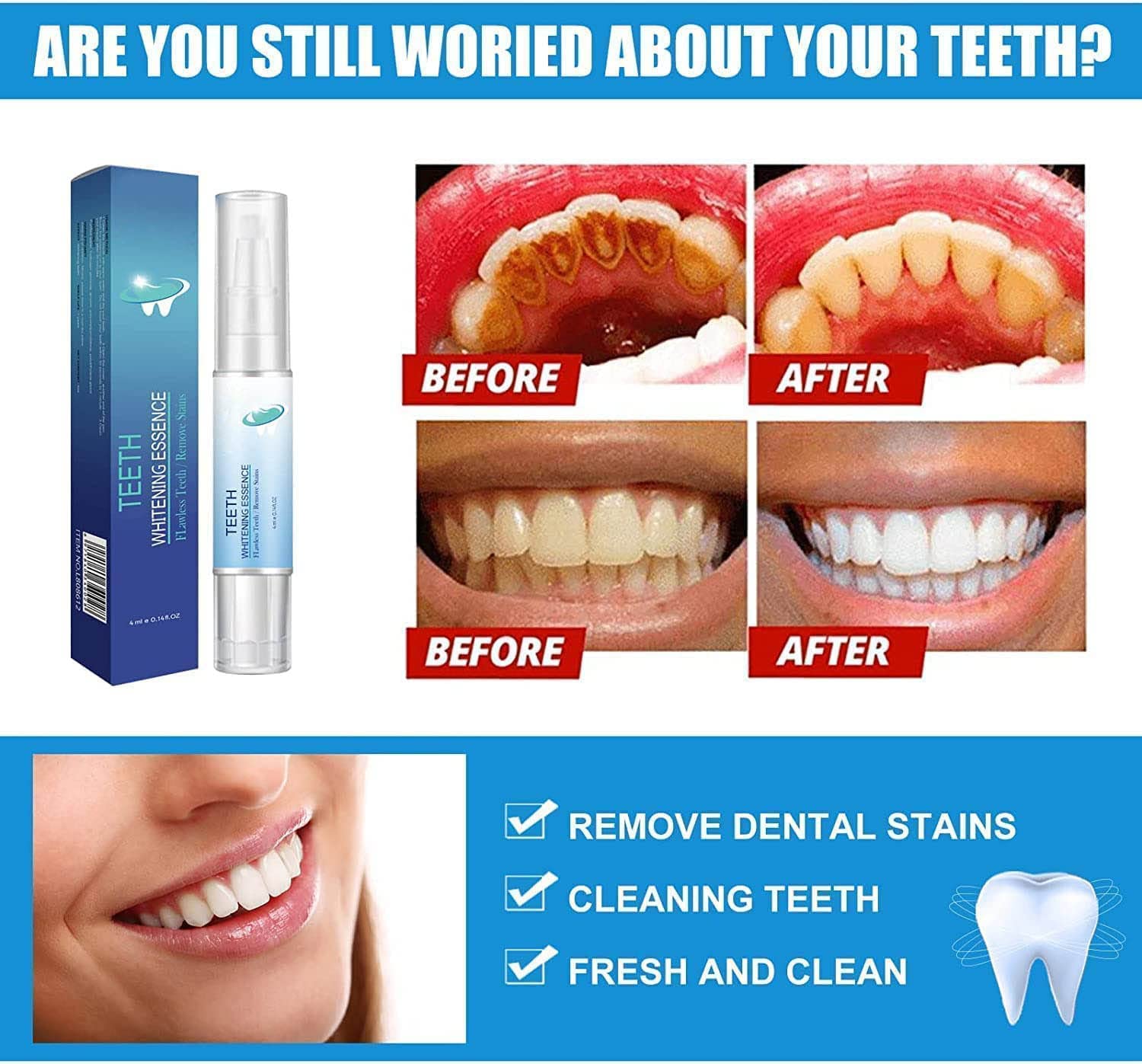 Herbaluxy Teeth Whitening, Teeth Whitening Pen, Purely White Deluxe Teeth Whitening Kit, Best Teeth Whitening Products, Intensive Stain Removal Teeth Reduce Yellowing (3pcs)