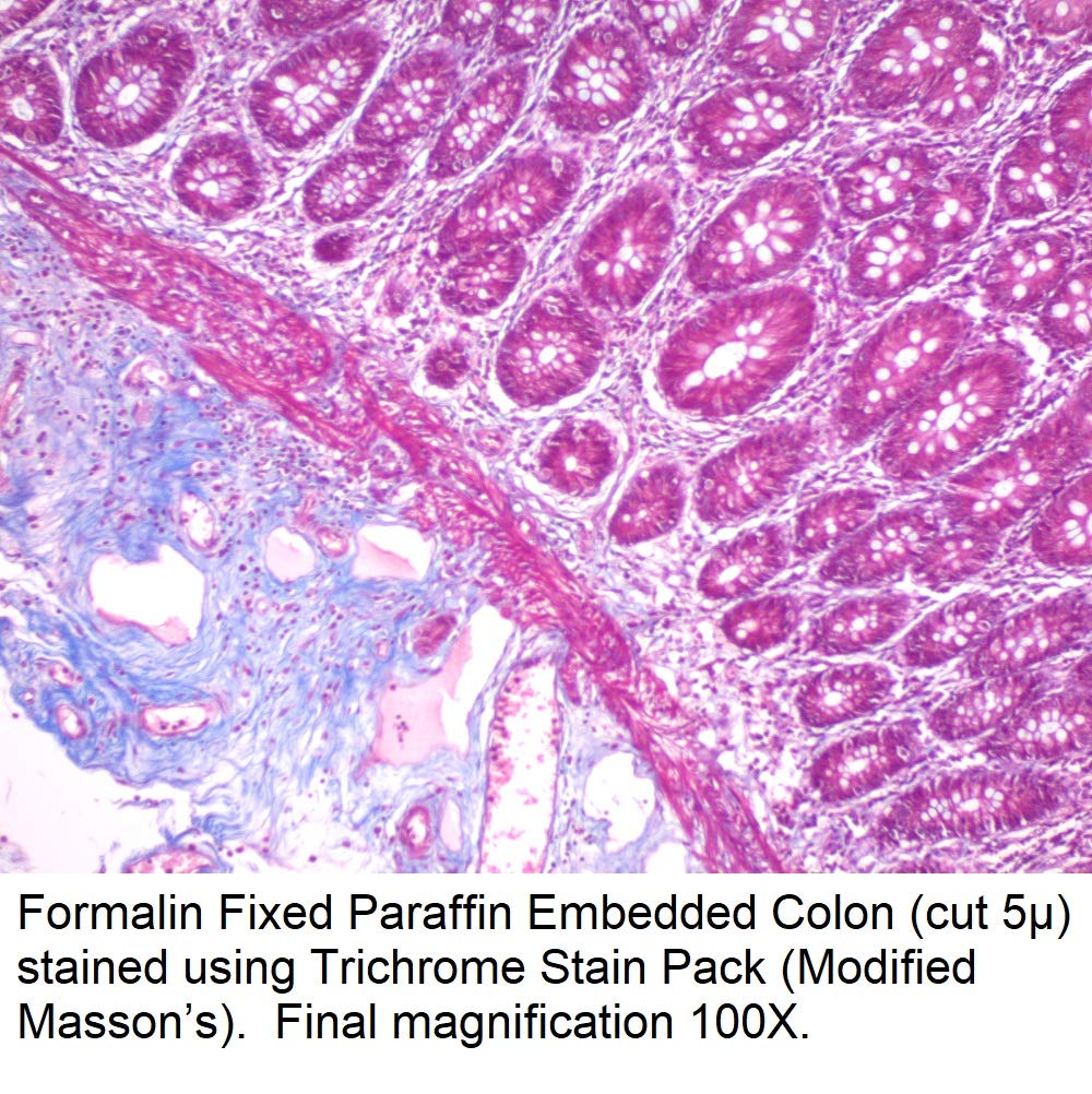 Trichrome Stain Pack (Modified Masson’s), 125ml