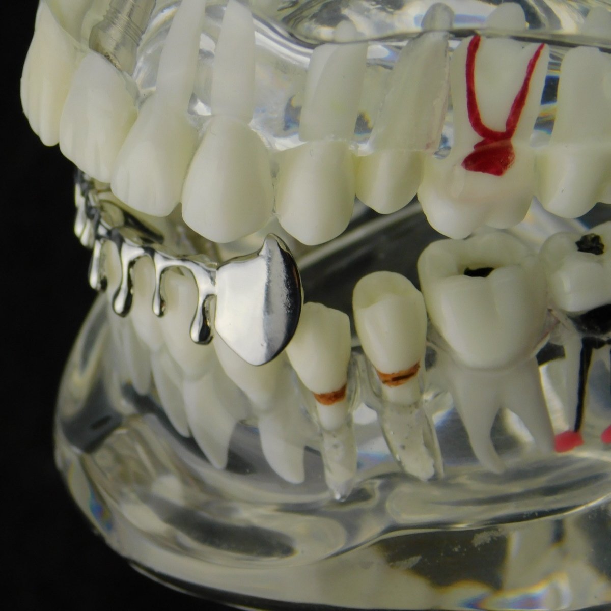 Fang Drip Grillz Bottom Teeth Fangs Silver Tone Hip Hop Vampire Dripping Pre-Made Grills