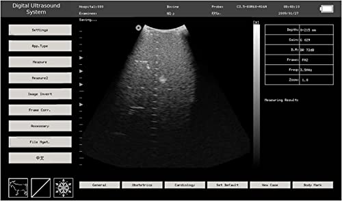 Portable Vet Veterinary B-Ultrasound Scanner,for Pregnancy,with Convex Probe for Horse,Goat,Cow,Sheep and Pig, CMS600P2 Vet CONTEC(Convex Probe)
