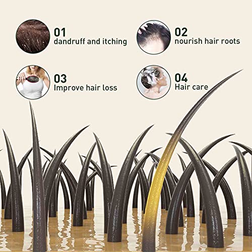 LANEMAY Ginger Essence Hair Growth Spray, Pure Ginger Prevent Hair loss Hair Growth Spray - 30ml