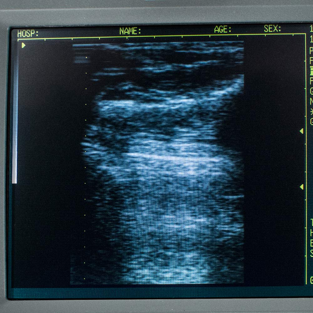 Veterinary Ultrasound Scanner HandScan V8 for Pregnancy Digital Veterinary Ultrasonic Scanner Machine with Convex Probe for Farm Animals Pet - US New Version