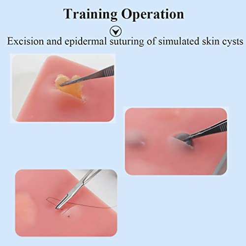 Model Teaching Model Cyst Model Skin Cyst Excision Model Training Suture Pad Skin Model Lipoma Model for Medical Practice for Teaching