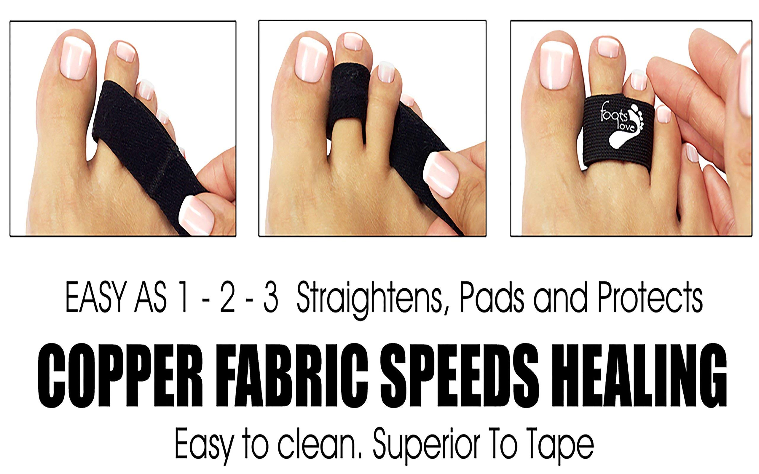 FOOTS LOVE - Broken Toe Splints. Crooked Toe Separator Hammer Toe Straightener Wraps. The Only Copper Align, Protect & Heal Brace. Even Better Now With No Slip !