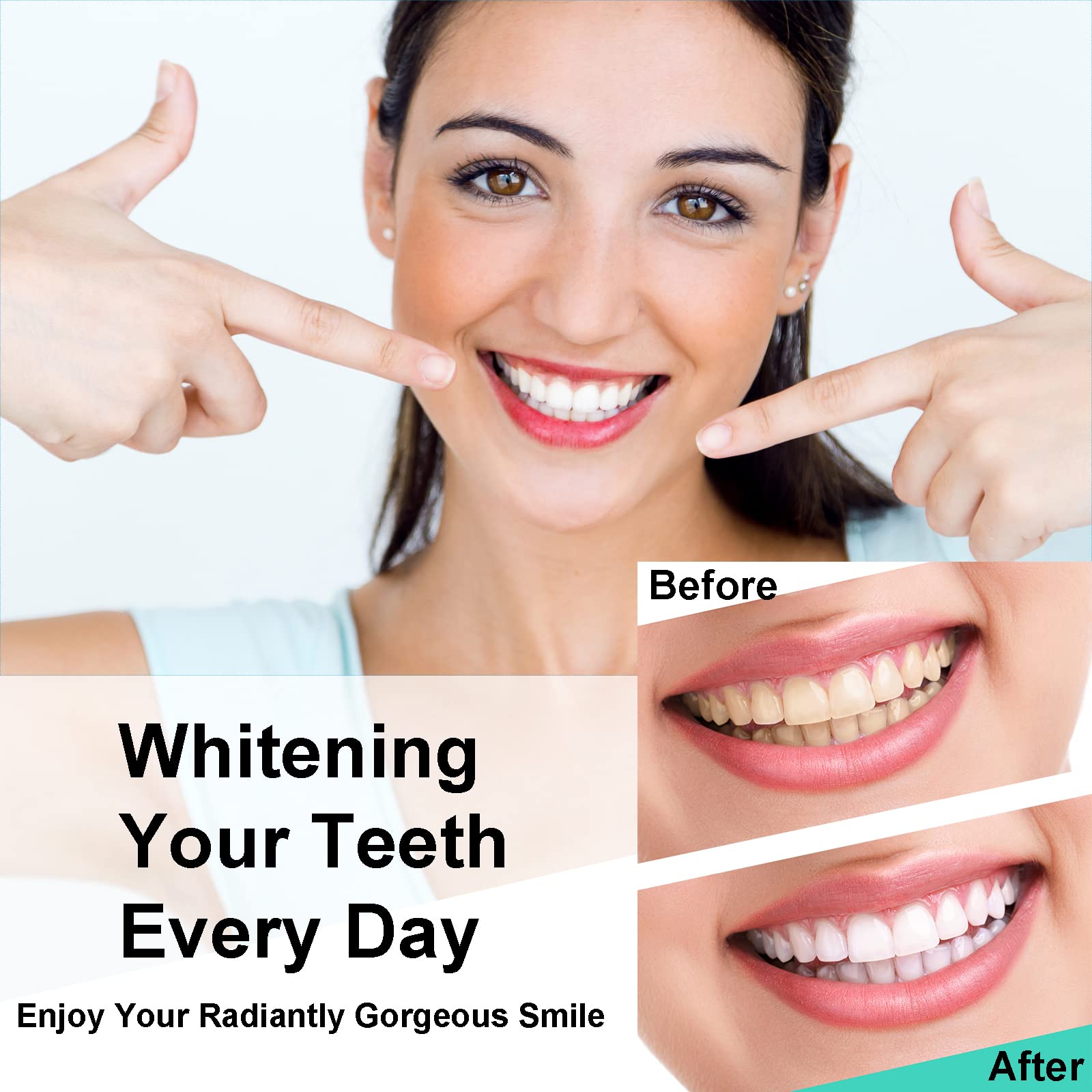 Led Teeth Whitening Light, TYTCA Teeth Whitening Accelerator Light with 16x More Powerful Blue LED Light Connected with iPhone/Android/USB for Home Use Helps Effectively Remove All Kinds of Stain