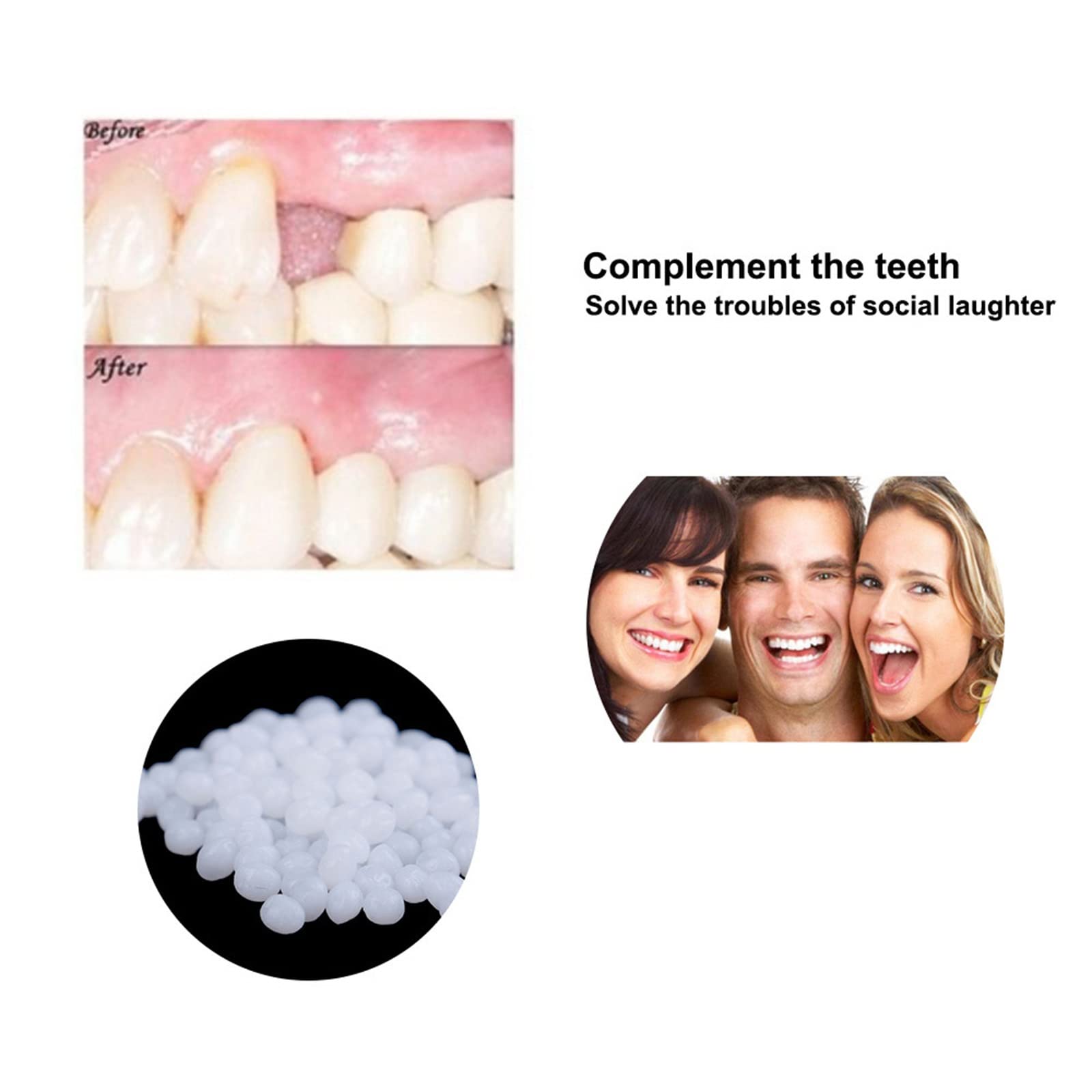 LTQUS Temporary Tooth Repair Beads-Teeth Repair Kit, Moldable False Teeth, Thermal Fitting Beads for Missing Dental Filling Material with Broken Teeth(30g)