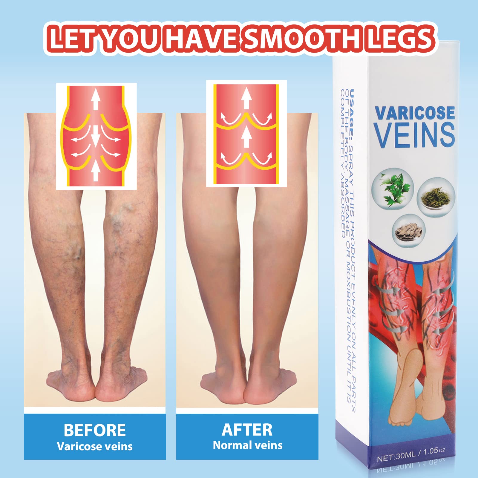 MAITING 2Pcs Veinhealing Varicose Veins Treatment Spray, Varicose Veins Miracle Spray, Vein Healing Varicose Veins Treatment Spray, 2 x 30 ml