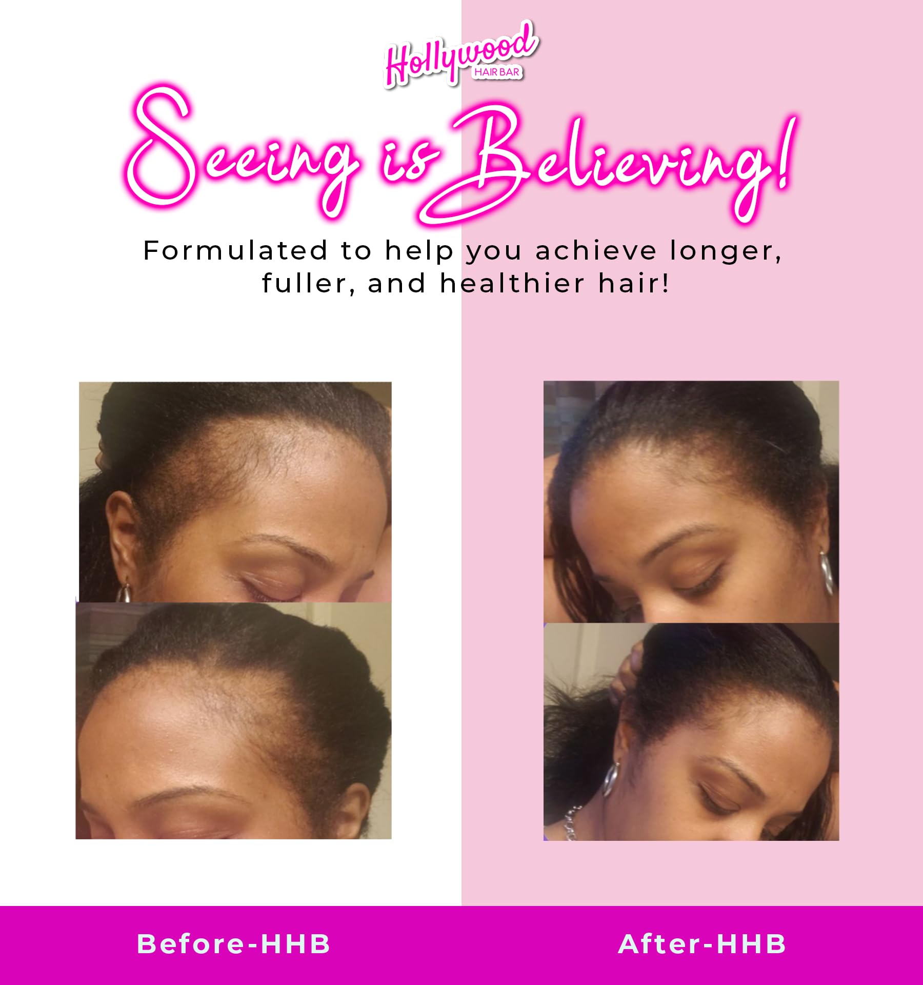 Hollywood Hair Bar Super Grow Scalp Balm - Revitalizing Scalp Balm, Vegan and Cruelty Free, 4 oz