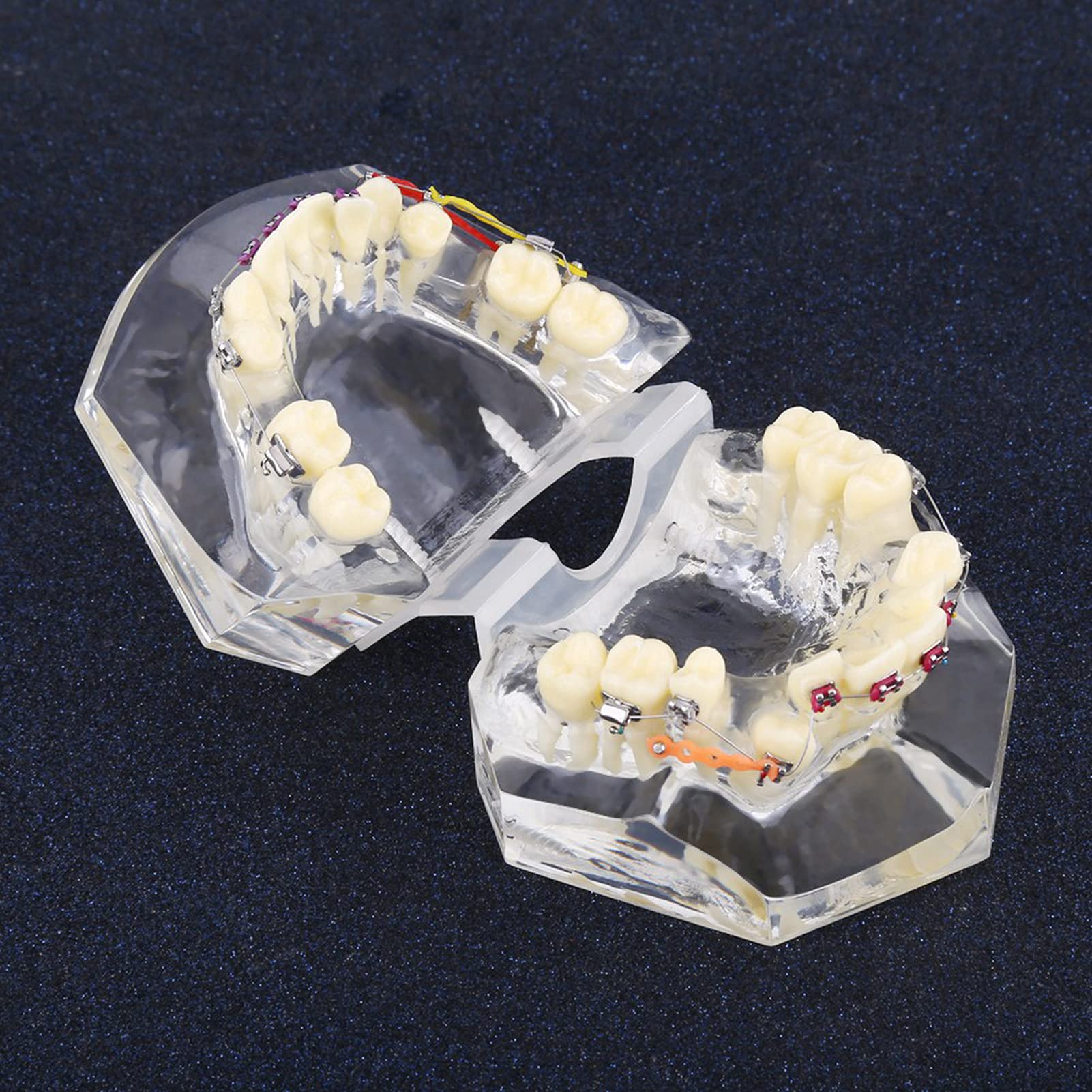 Orthodontic Teeth Model with Metal Brackets and Wires for Adult and Children Malocclusion Study and Braces Demonstration