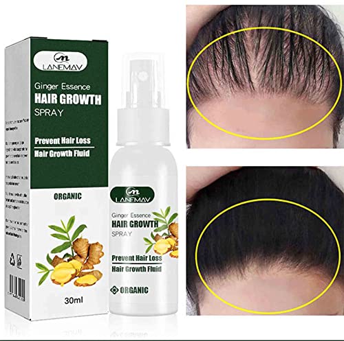 LANEMAY Ginger Essence Hair Growth Spray, Pure Ginger Prevent Hair loss Hair Growth Spray - 30ml