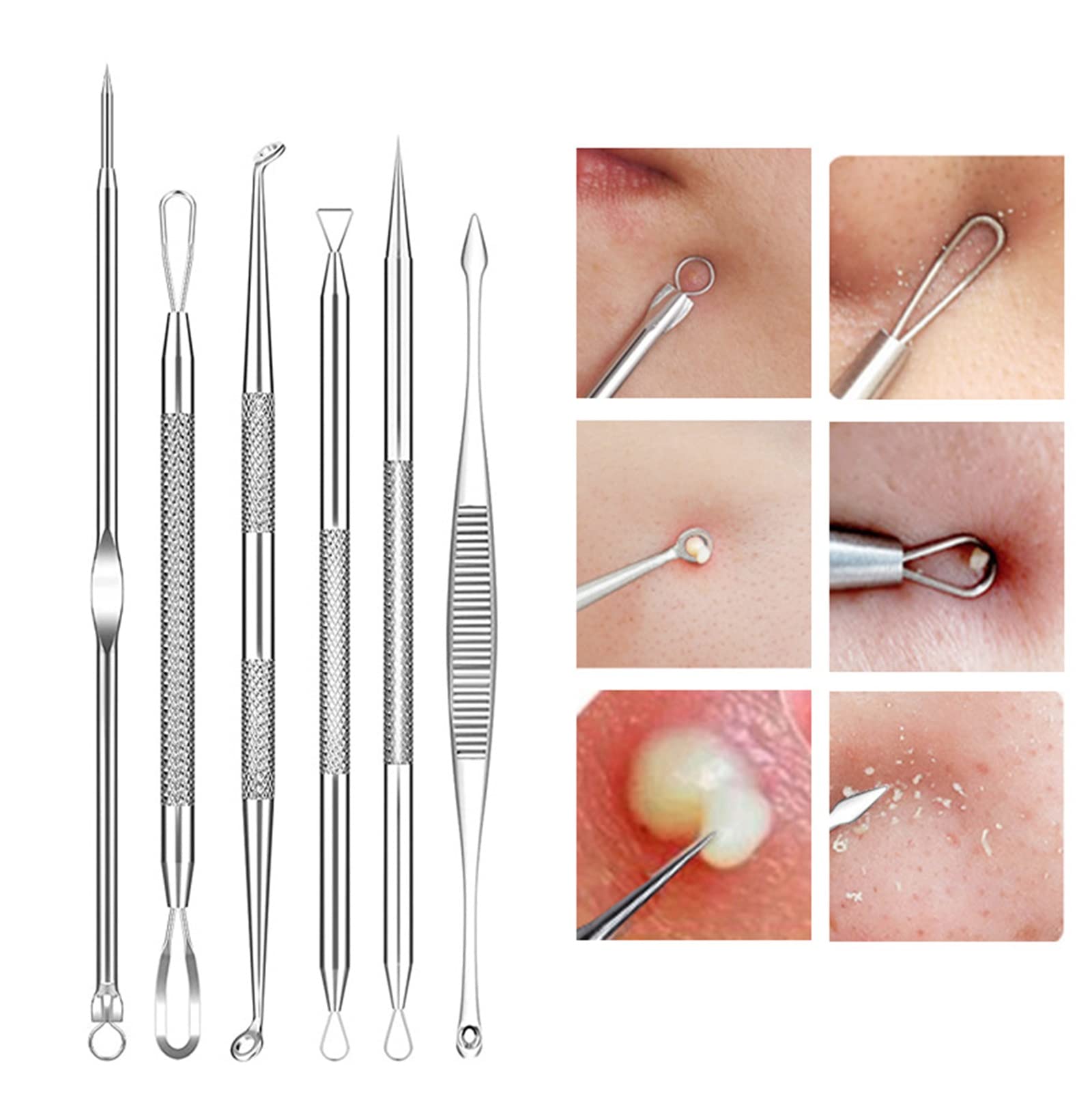 Pimple Popper Tool Kit, Blackhead Remover Tools, Extraction Tools for Estheticians, Black Head Extractions Tool Professional, Comedone Extractor, Beauty Acne Removal Blemish Set with Metal Case(15PCS)