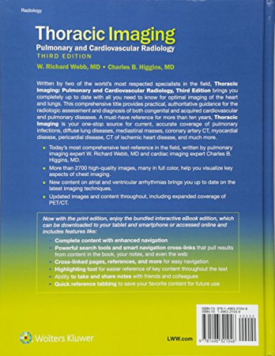 Thoracic Imaging: Pulmonary and Cardiovascular Radiology