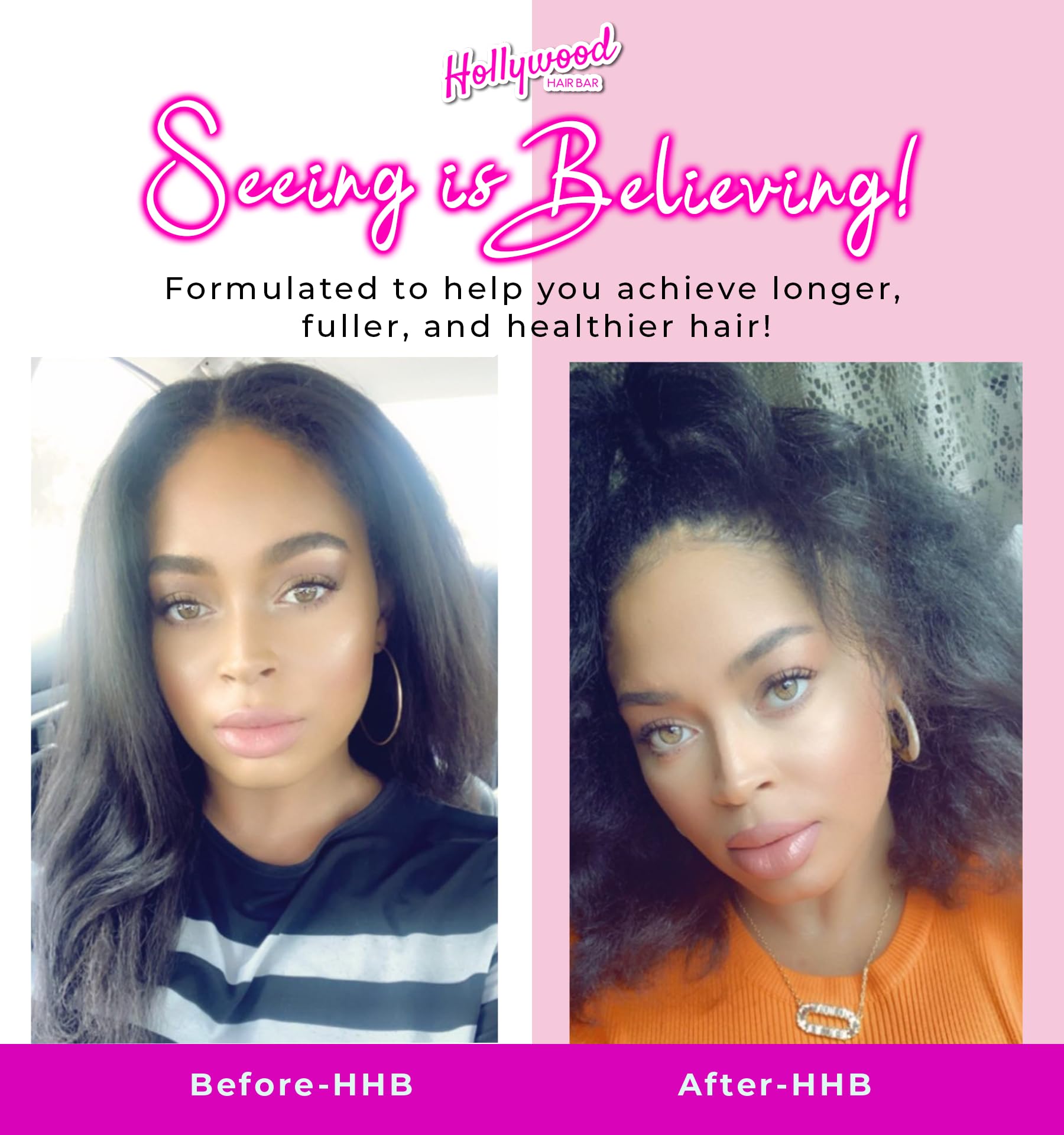 Hollywood Hair Bar Super Grow Scalp Balm - Revitalizing Scalp Balm, Vegan and Cruelty Free, 4 oz