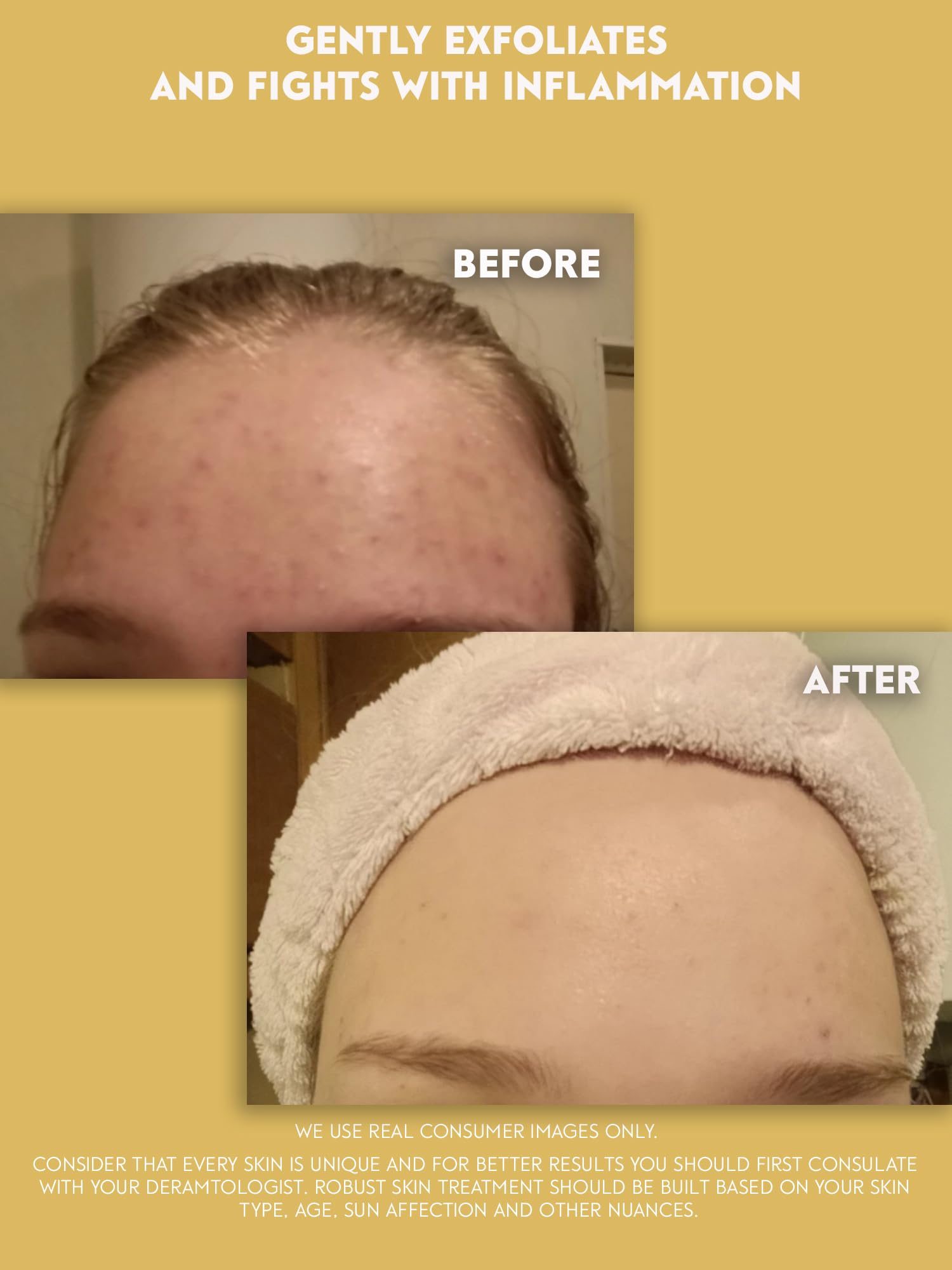 Exfoliating Pineapple Face Milk Serum with Olive Leaf Extract and Allantoin, 1 Fl Oz / 30 ml