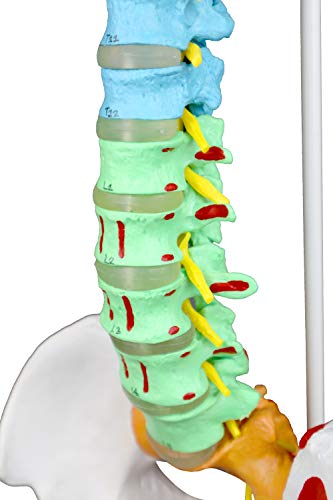 Vision Scientific VAV245 Flexible Spinal Column | 5 Color-Coded | Muscle W Occipital Bone | Sacrum, Coccyx, 24 Vertebrae, Soft Disc | Pelvic Bones & Femur Heads, Arteries, Nerve Endings | W Manual