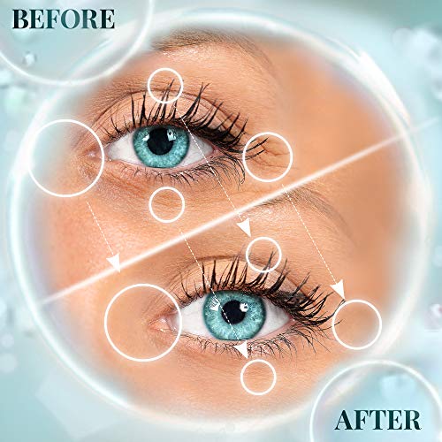 Eye Cream Moisturizer for Dark Circles, Fine Lines, Puffiness and Wrinkles Under the Eyes – Intensive Anti Aging Formula with Provitamin A and B5, Vitamin C and E – 1.7 fl oz (50ml)
