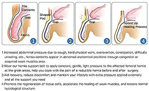 Inguinal Hernia Support Post Surgery Hernia Pain Relief Truss Brace for Single/Double Inguinal Or Sports Hernia with Two Removable Compression Pads Groin Straps Surgery Injury Recovery Hernia Belt