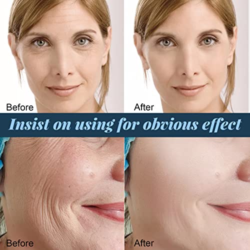Proform Korean Soluble Protein Thread, Absorbable Collagen Thread for Face Lift, Nano Gold Soluble Protein Thread Strips, Soluble Protein Thread Lifting Instant Face Protein Thread (60PCS)