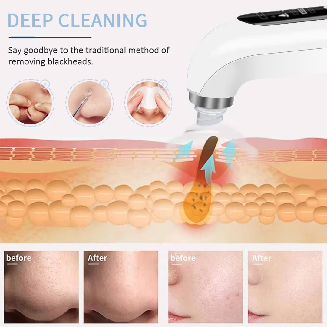 HydroFacial Blackhead Remover Pore Vacuum Micro Bubble Pore Cleansing Machine Pimple Extractor Tools with 6 Suction Heads,3 Gears Adjustable Beauty Device