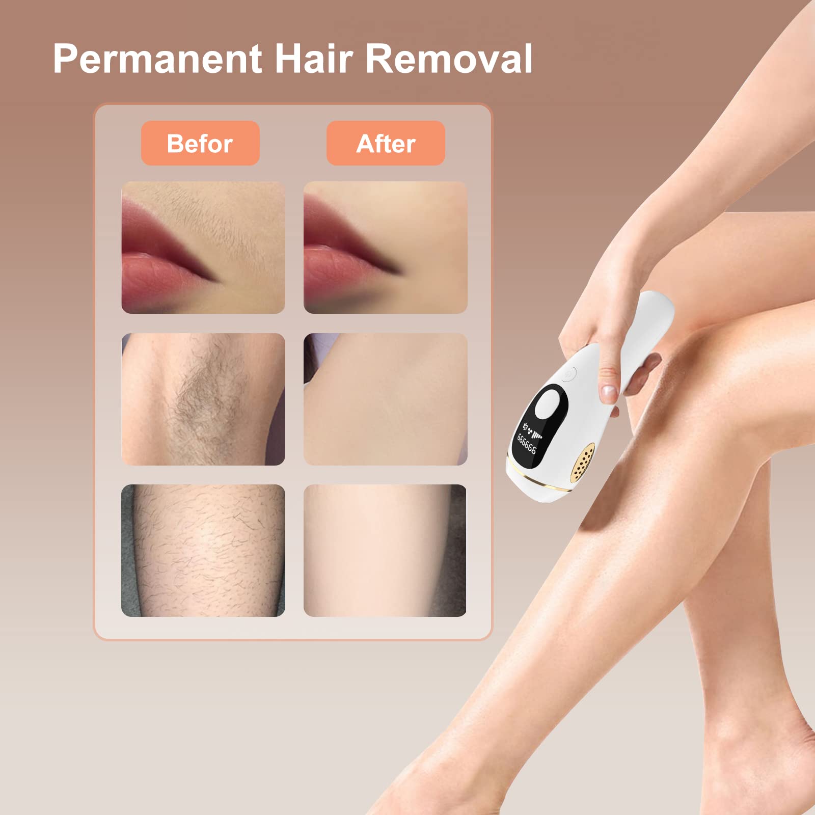 IPL Hair Removal Device, Model S1-A, For Women & Men At-Home, For Armpits Back Legs Arms