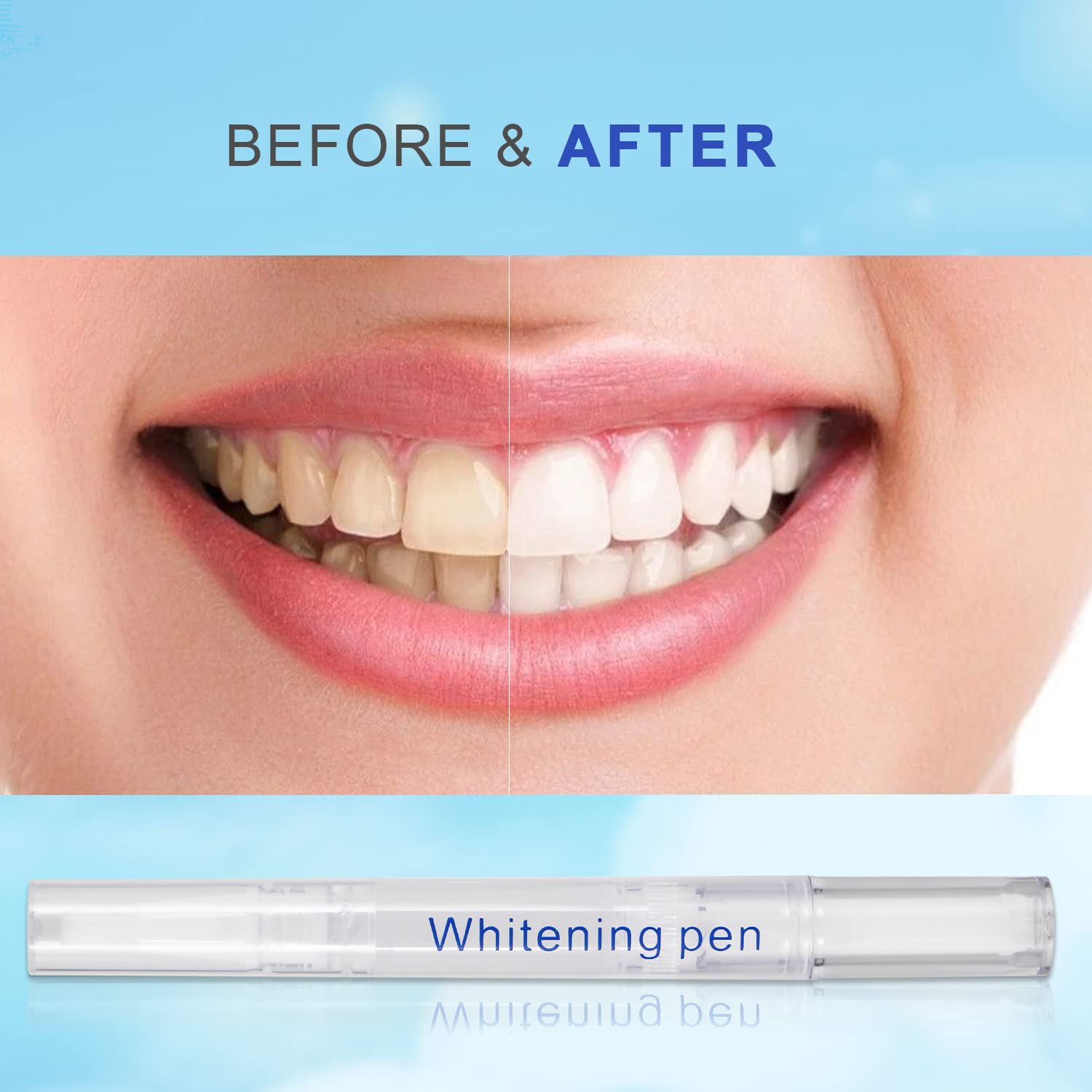 Kingheroes Teeth Whitening Pen(4 Pcs), 30+ Uses, Effective, Painless, No Sensitivity, Travel-Friendly, Easy to Use, Beautiful White Smile, Natural Mint Flavor
