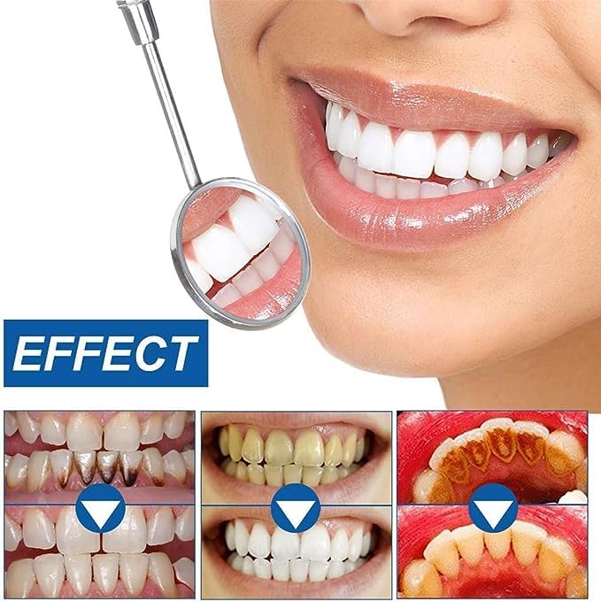 Fortbite Tooth Powder, Fortbite Toothpaste, Fortnite Toothpaste Bentonite Clay,Tooth Powder Stain Removal,Keep Your Teeth and Gums Health (2*PCS)
