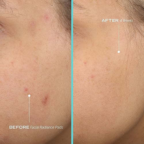 First Aid Beauty Facial Radiance Pads β Daily Exfoliating Pads with AHA that Help Tone & Brighten Skin β 60 Count
